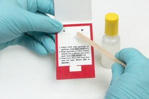 Faecal Occult Blood Test – National Foundation For Digestive Diseases